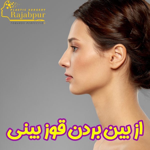 7 روش موثر برای از بین بردن قوز بینی | رفع قوز بینی به صورت کاملا موثر